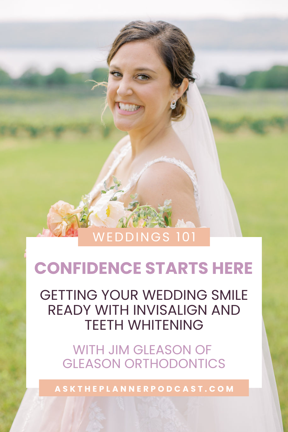 Getting Your Wedding Smile Ready | Verve Event Co.